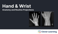 Hand & Wrist: Anatomy & Routine Projections | Video Lesson | Clover Learning