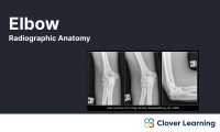Elbow: Radiographic Anatomy | Video Lesson | Clover Learning