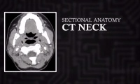 CT Neck (Axial) | Video Lesson | Clover Learning
