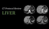 CT Liver | Video Lesson | Clover Learning