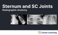 Sternum & SC Joints: Radiographic Anatomy | Video Lesson | Clover Learning